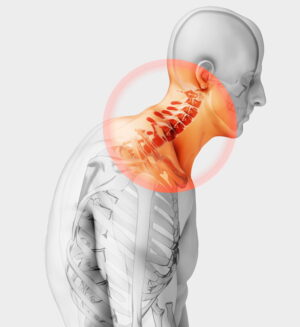 CERVICALGIA O DOLOR CERVICAL - Fisiobalance