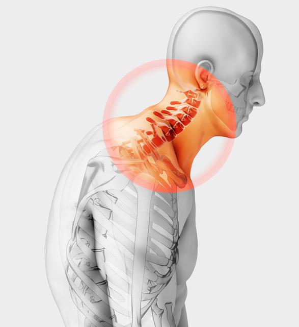 DOLOR DE CABEZA Y LAS CERVICALES - Fisiobalance