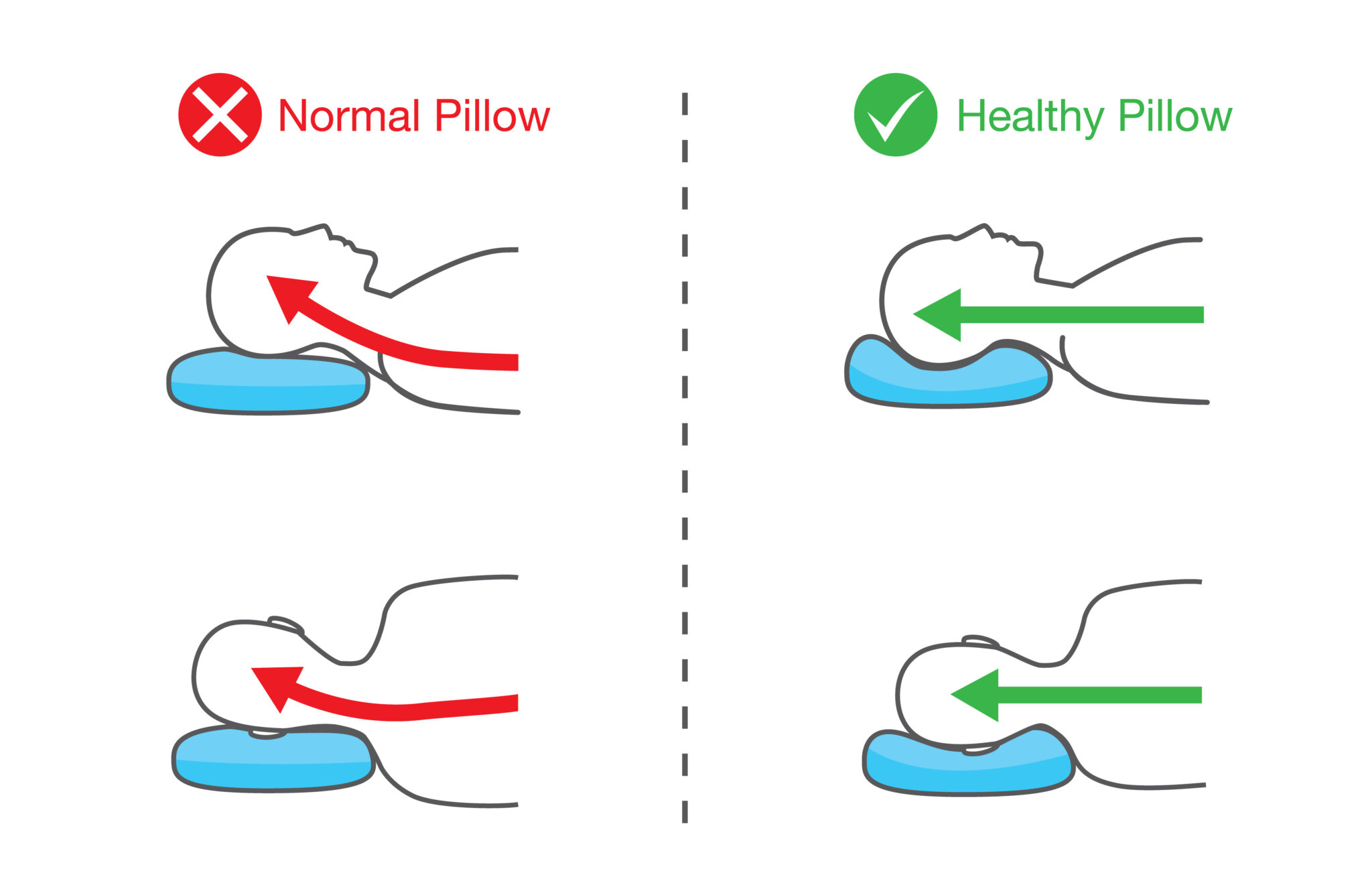 CERVICALGIA O DOLOR CERVICAL - Fisiobalance